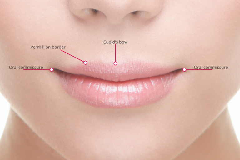 Downturned Lips