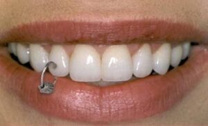 Coin Slot Piercing