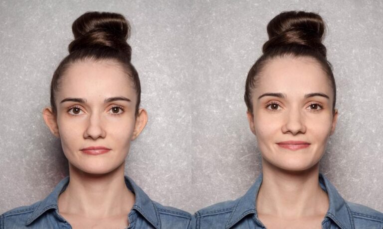 Ear Plastic Surgery