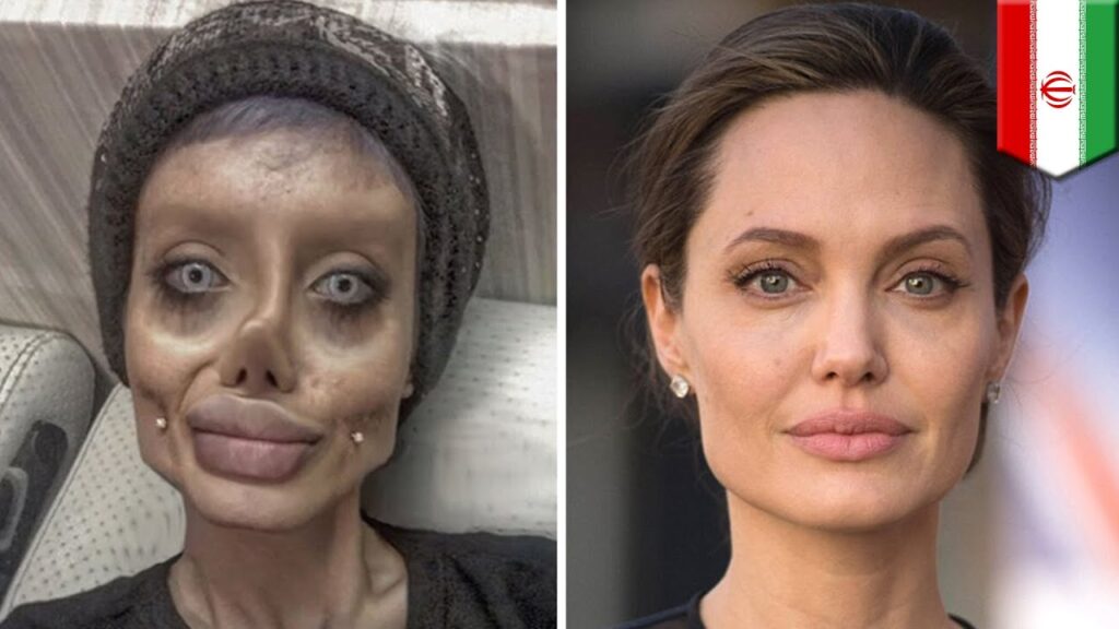 Extreme Plastic Surgery
