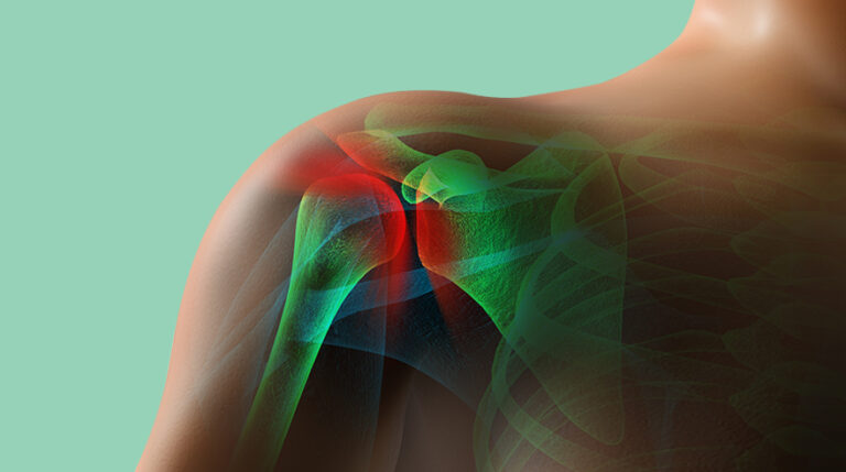 Types Of Injections For Shoulder Pain
