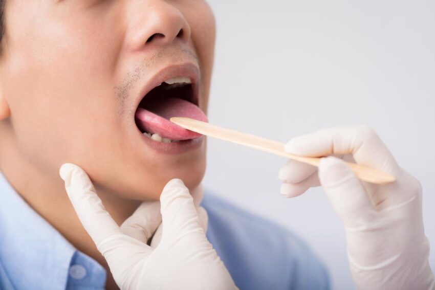 Swollen Taste Buds on Tongue