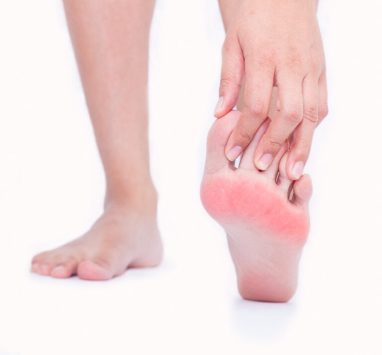What is the sesamoid bone in the foot?