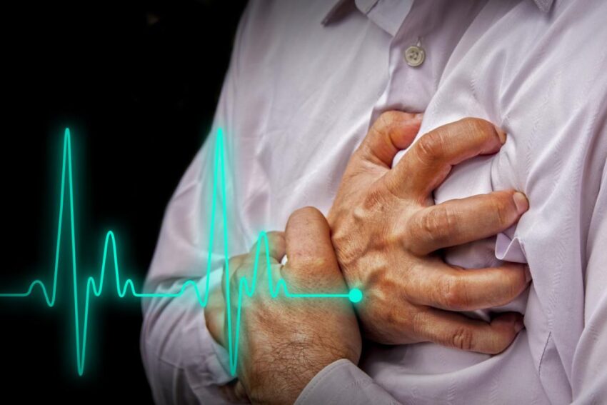 What is a tombstone on ECG?