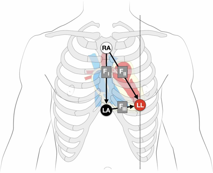 Why is a 12 lead ECG used?