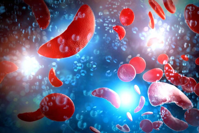 Alcohol Anemia